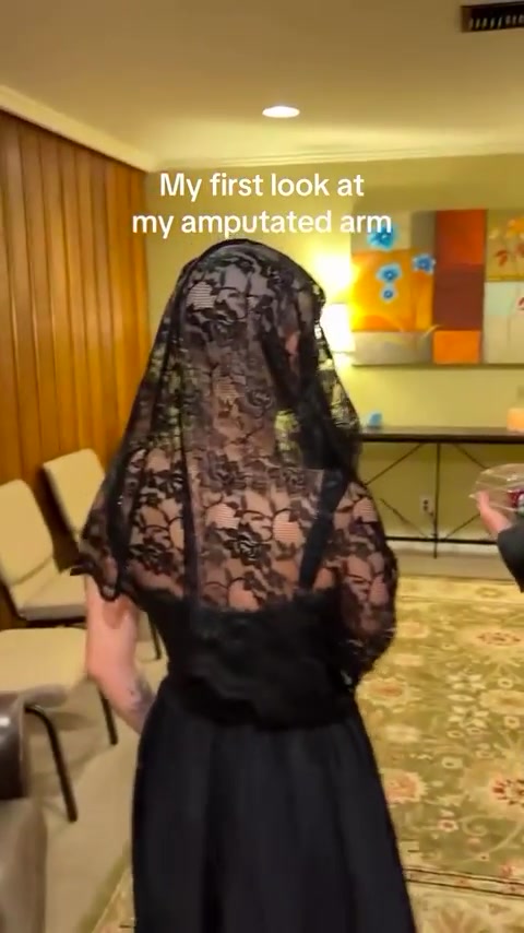 A Heartfelt Farewell: The Funeral of an Amputee Arm | [meme.am]